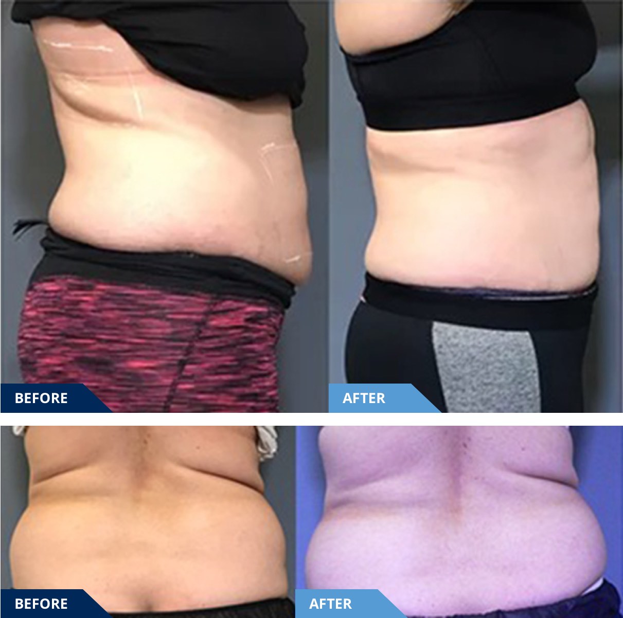 Trusculpt 3d Body